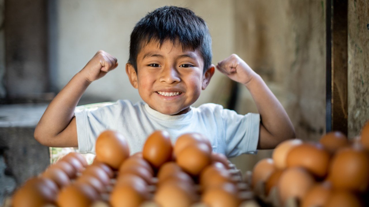 ¿Qué es la malnutrición y cómo afecta a la niñez de Guatemala? - World ...